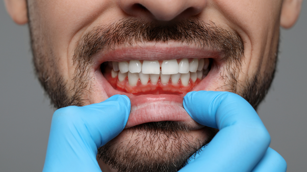 The Comprehensive Guide to Periodontal Disease Staging and Grading