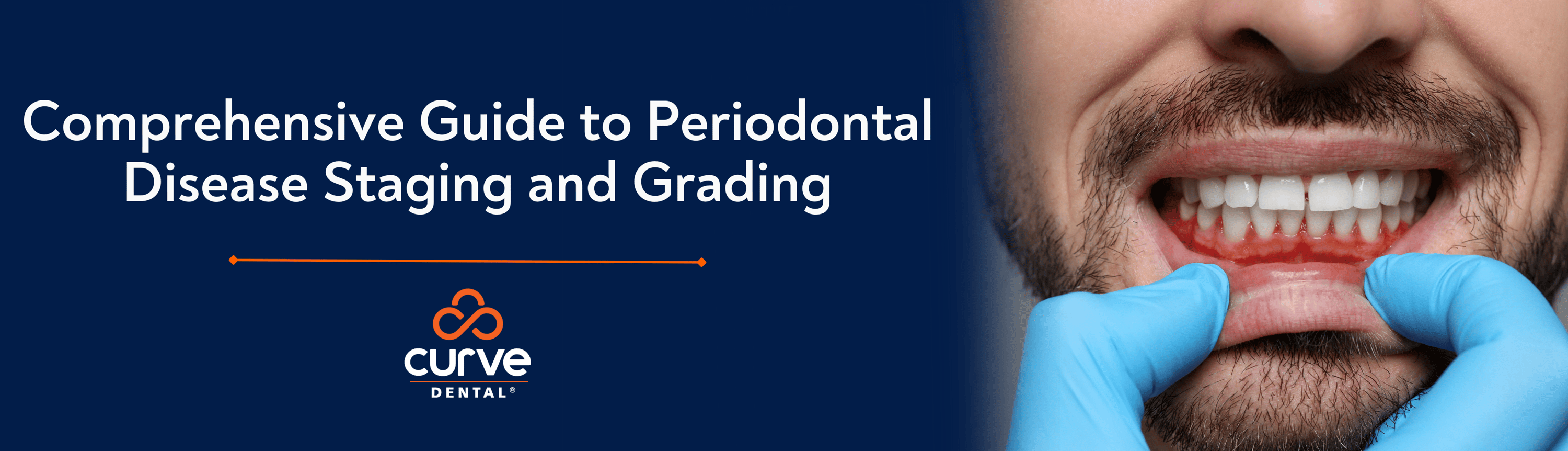 The Comprehensive Guide to Periodontal Disease Staging and Grading