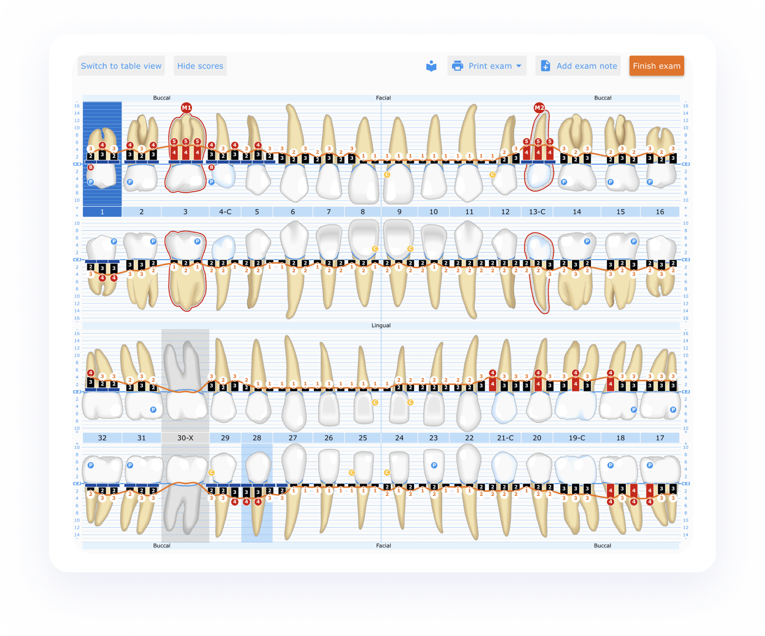 Curve Dental: Efficient Perio Charting