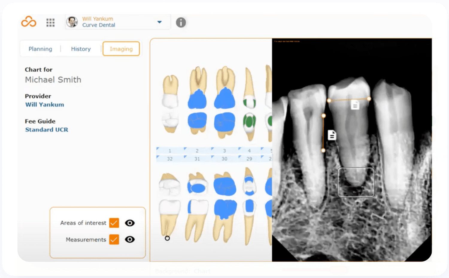 Curve Dental Imaging Software: Enhanced Clarity & Workflow