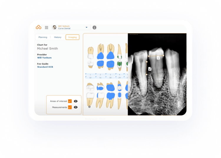 Curve Dental: All-in-One Dental Software