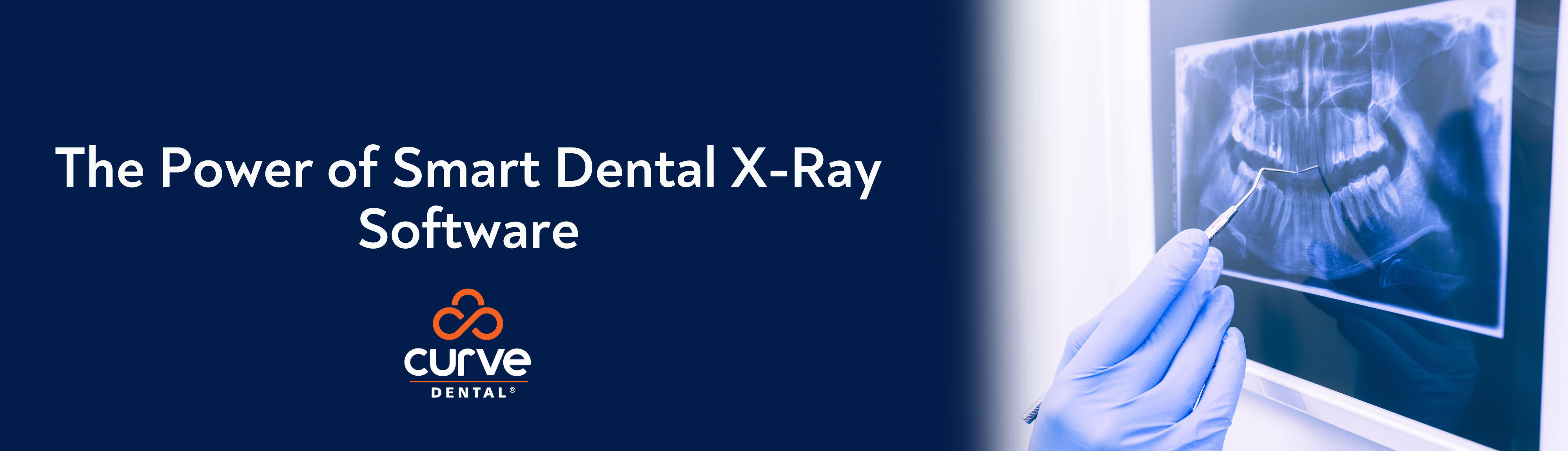 From Capture to Diagnosis: The Power of Smart Dental X-Ray Software