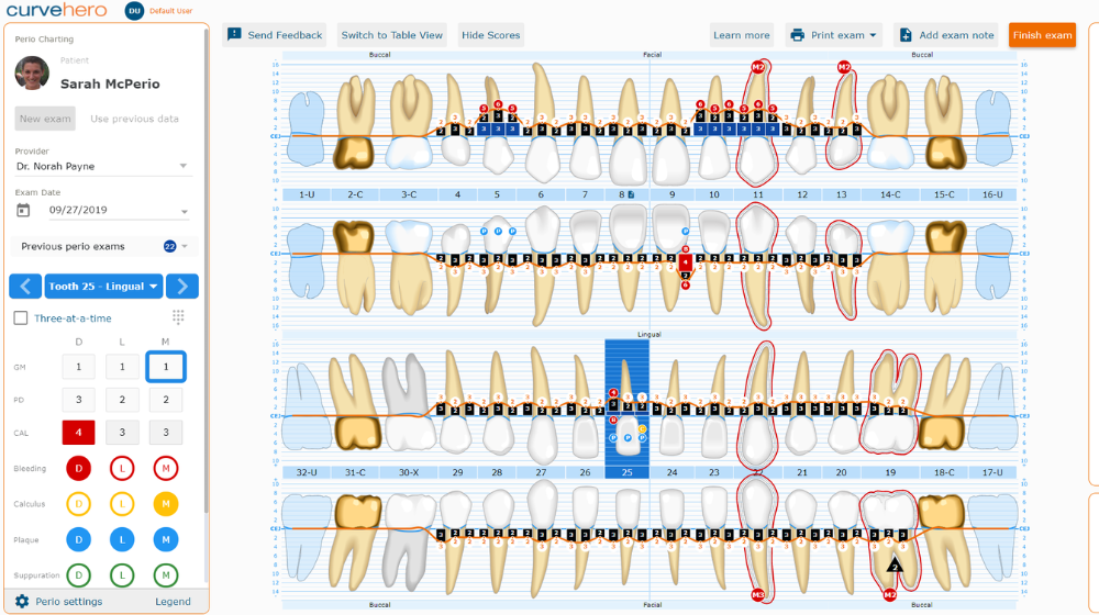 Understanding Dental Charting: Key Insights for Optimal Oral Health