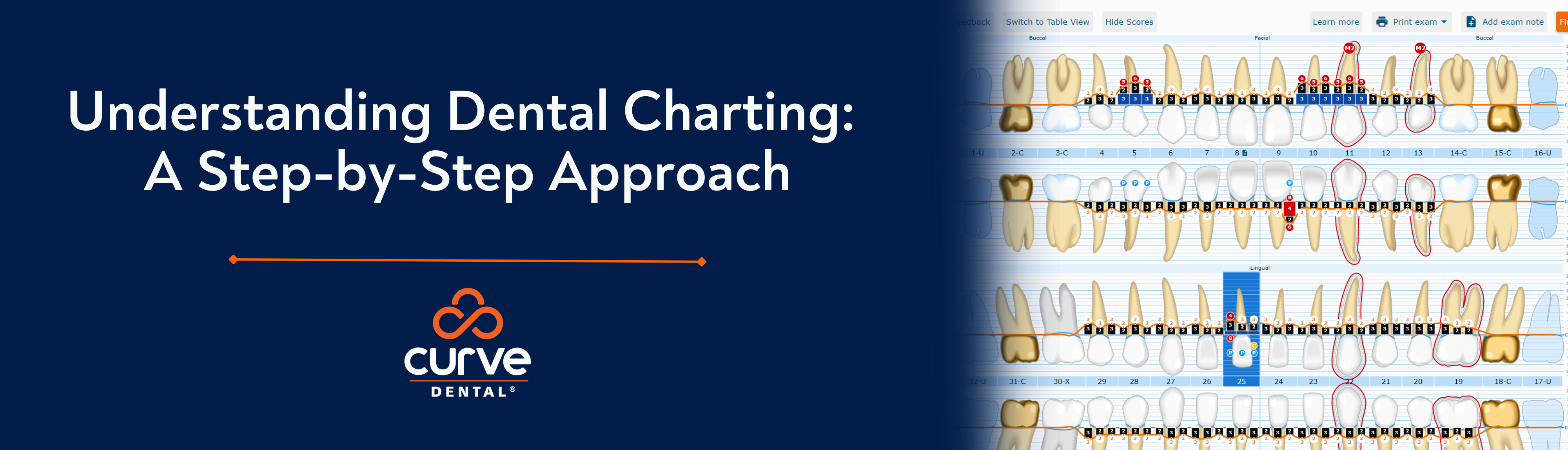 Understanding Dental Charting: Key Insights for Optimal Oral Health