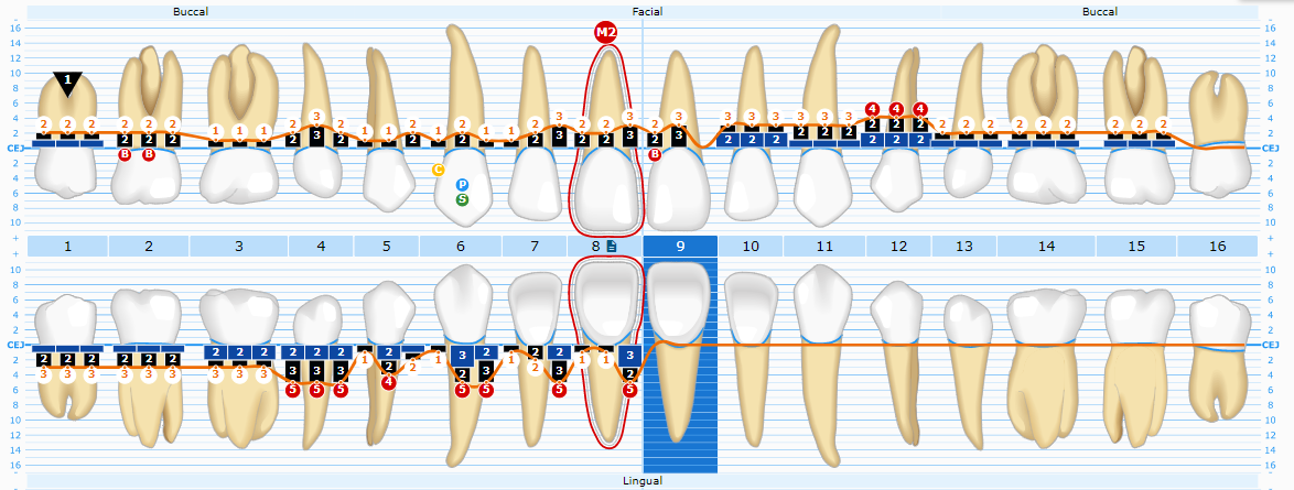 You Are In Control With Our Perio Charting Update