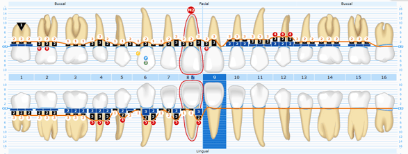 You Are In Control With Our Perio Charting Update