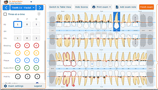 Perio Charting Curve Dental Practice Management Software