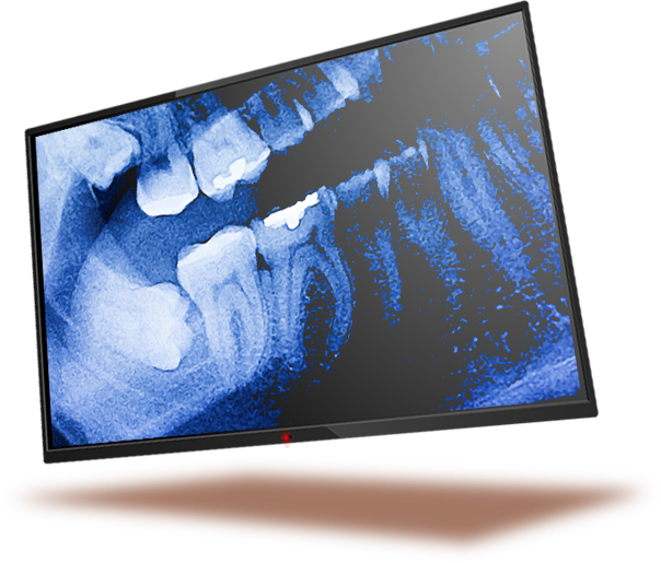 Dental Image Software | Curve Dental