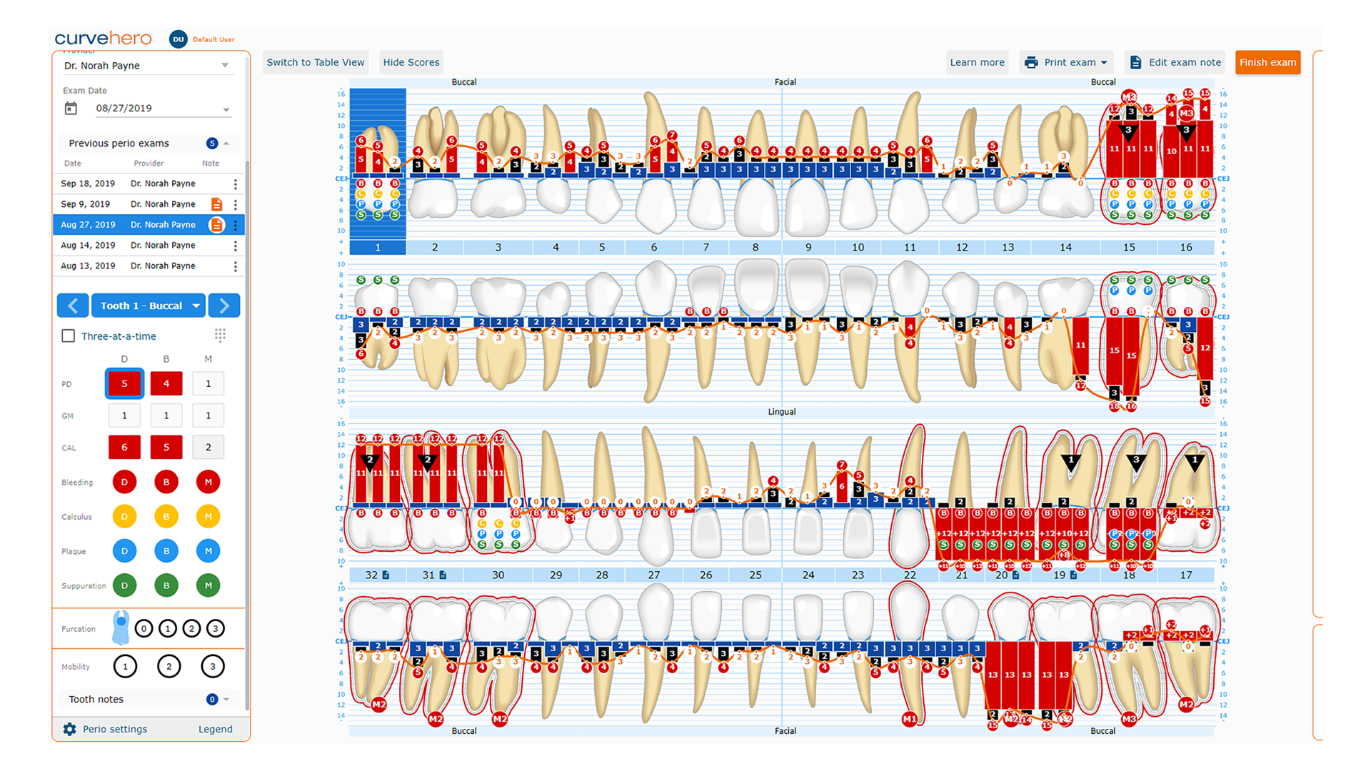 Dental Perio Charting Printable Dental Perio Chart Form 023NLN